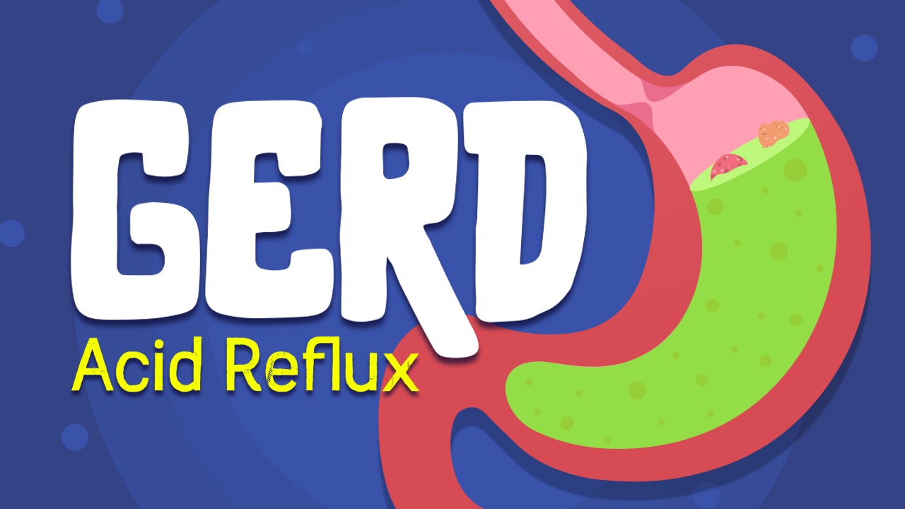 Acid Reflux (GERD) – Dr Smart Team